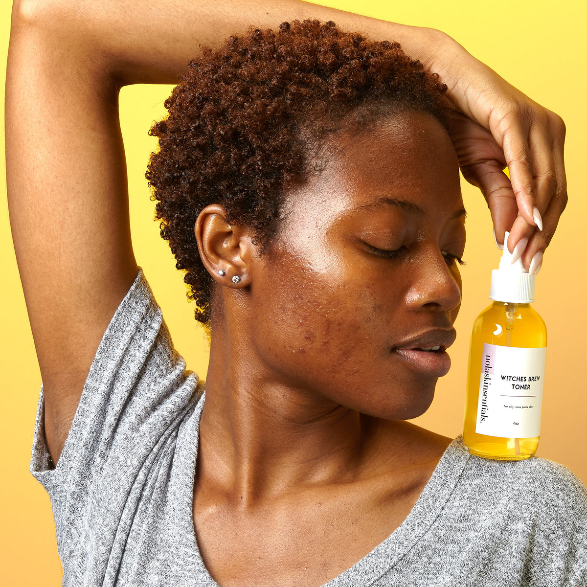 Oily Skin — Nolaskinsentials