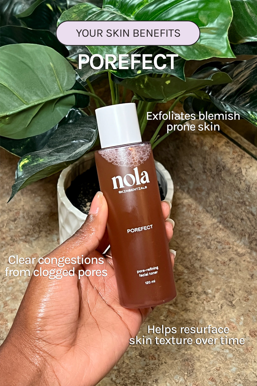 For Hyperpigmentation | Nolaskinsentials